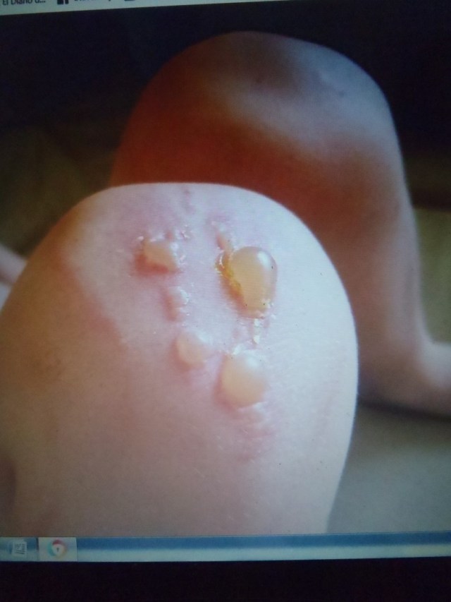 Yucatan Plants that Harm … and Heal | Surviving Yucatan